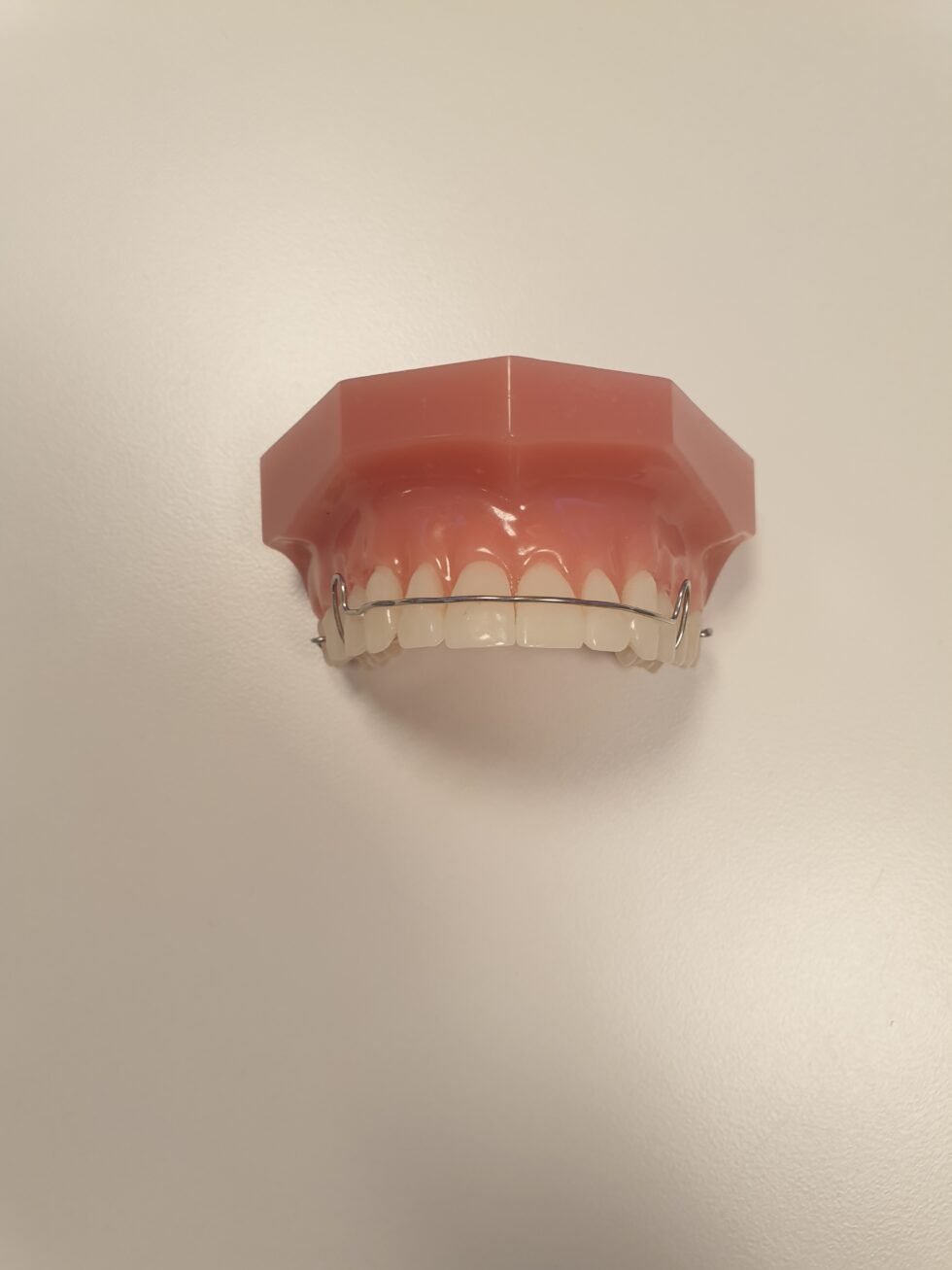 beugelsoorten - Orthodontiepraktijk Putten